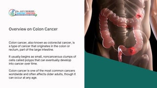 Colon Cancer and Its Treatment Options.pdf