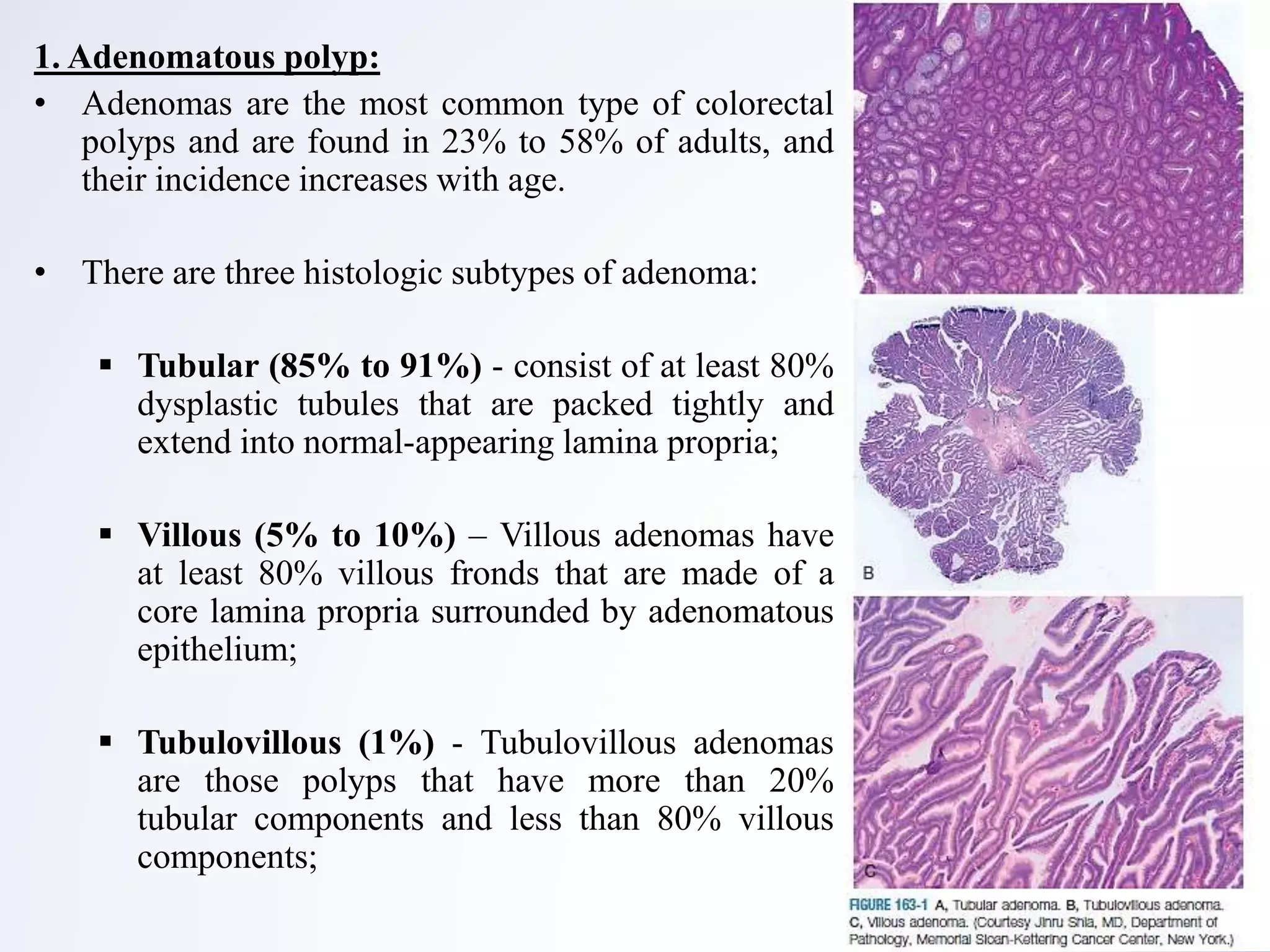 Colon cancer epidemiology to staging | PPTX