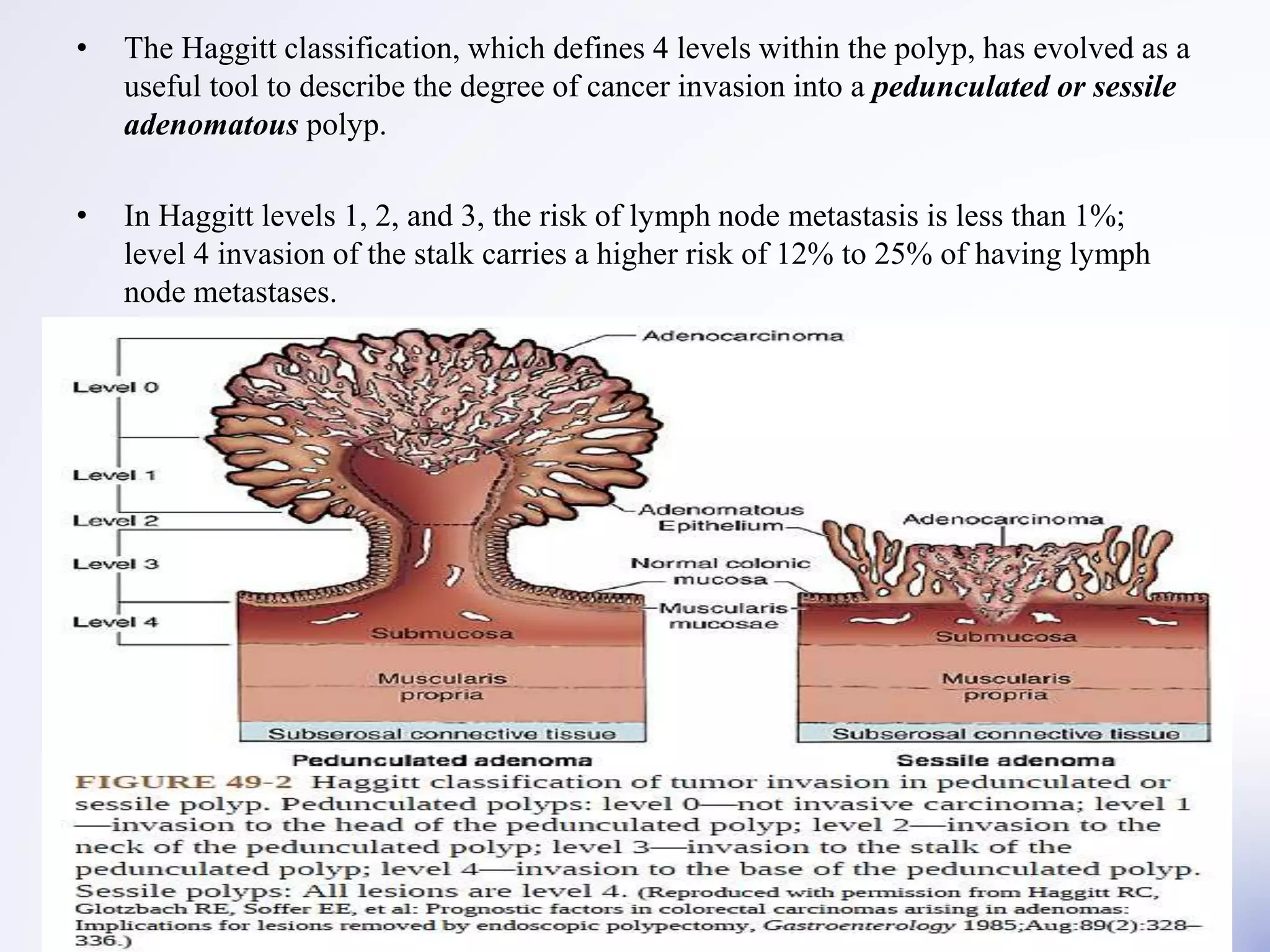 Colon cancer epidemiology to staging | PPTX