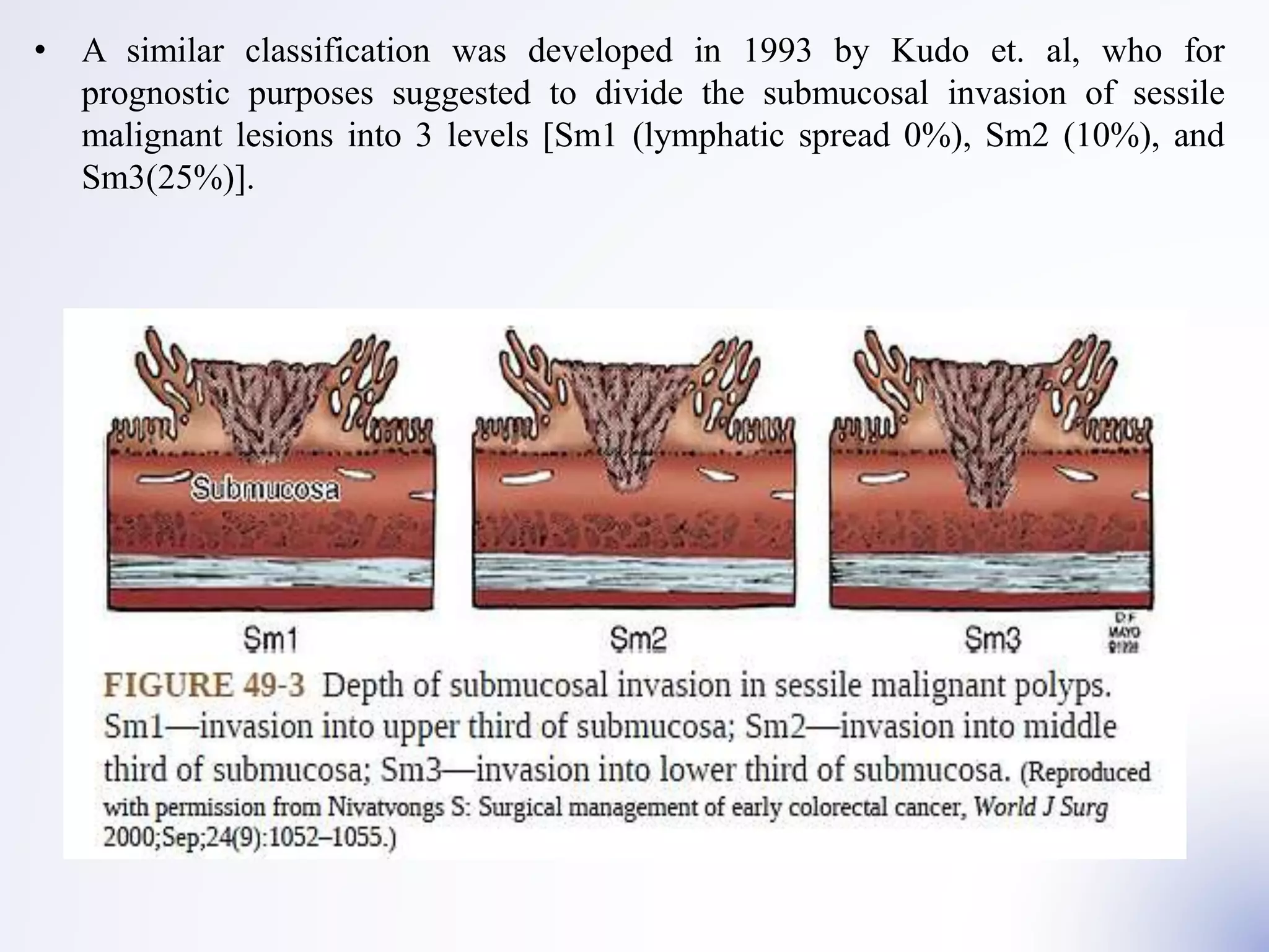 Colon cancer epidemiology to staging | PPTX