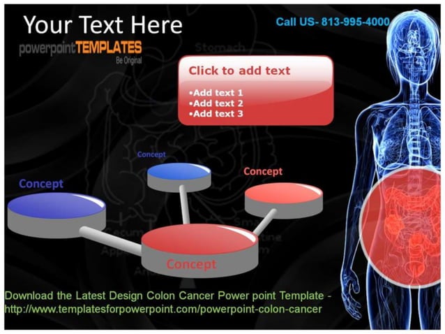 Latest Design Colon Cancer Power point Template | PPTX