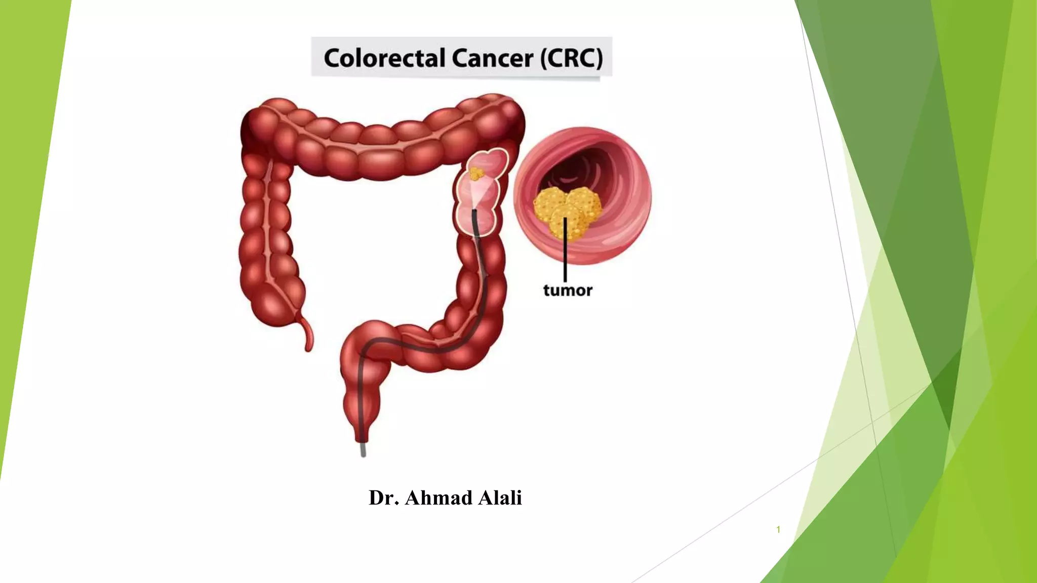 Colon cancer screening | PPTX