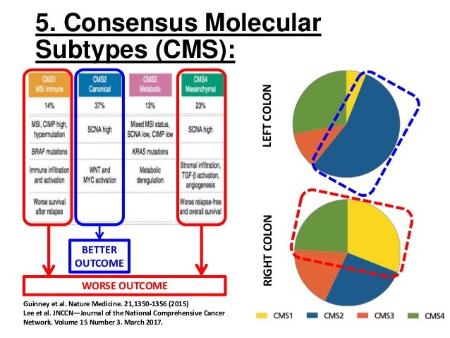 Colon cancer sidedness 2018