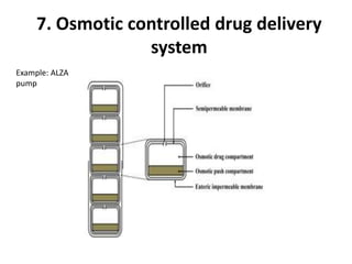 Colon drug delivery system | PPTX