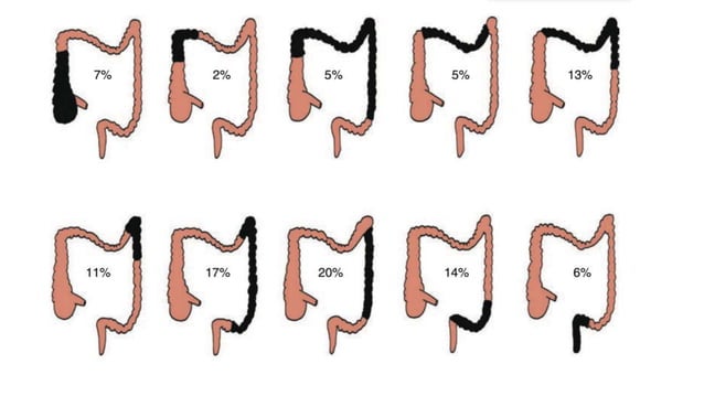 COLONIC BLEEDING a presentation on general surgery.pptx