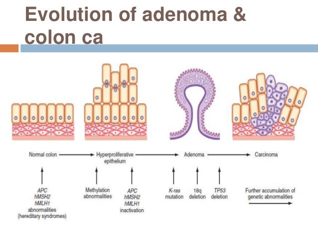 Colonic neoplastic polyps