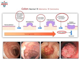 COLONIC POLYPS AND ITS FOLLOW UP PRESENTATION.pptx
