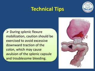 Colonic trauma, colon injury, colorectal trauma | PPTX