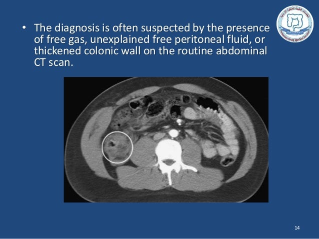 Colonic trauma, colon injury, colorectal trauma