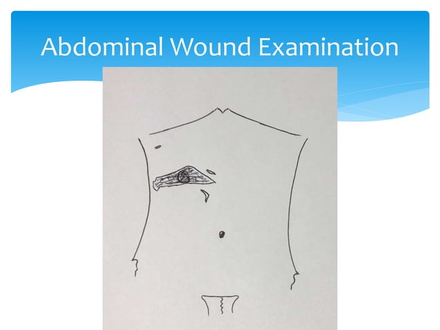 Colonic trauma | PPT