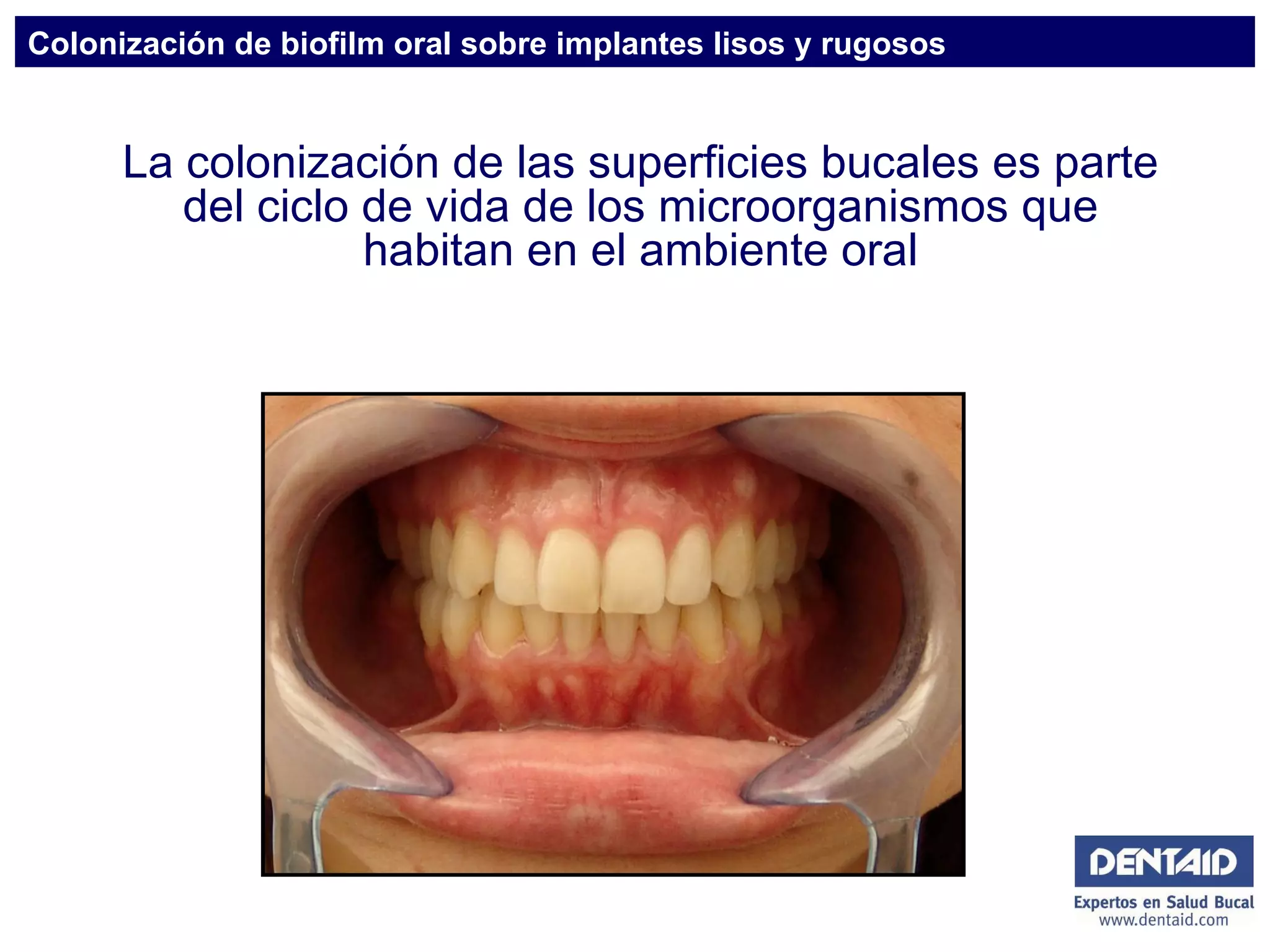 Colonización de biofilm oral sobre implantes lisos y rugosos | PPT