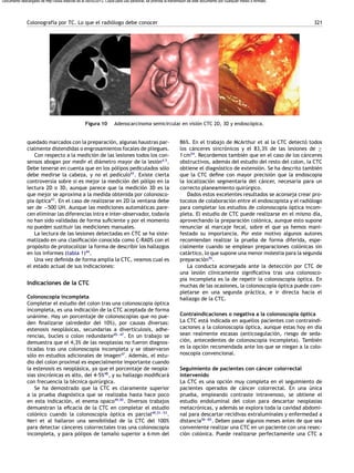 Colonoscopia Virtual | PDF