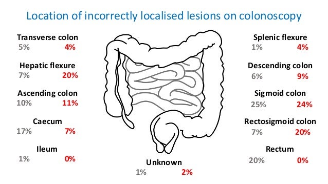 Colonoscopic localisation accuracy for colorectal resections