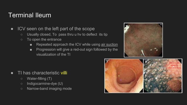 Colonoscopy | PPTX