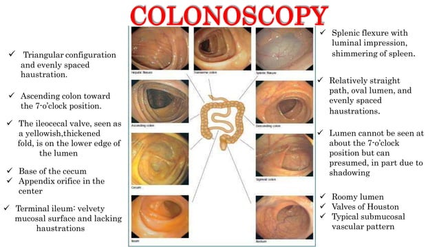 colonoscopy-ppt-190317111747.pptxpptxxxxxx | PPT