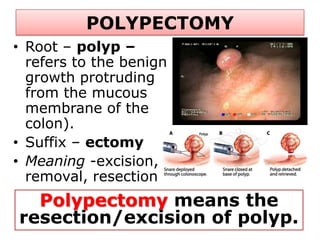 Colonoscopy with polypectomy | PPTX