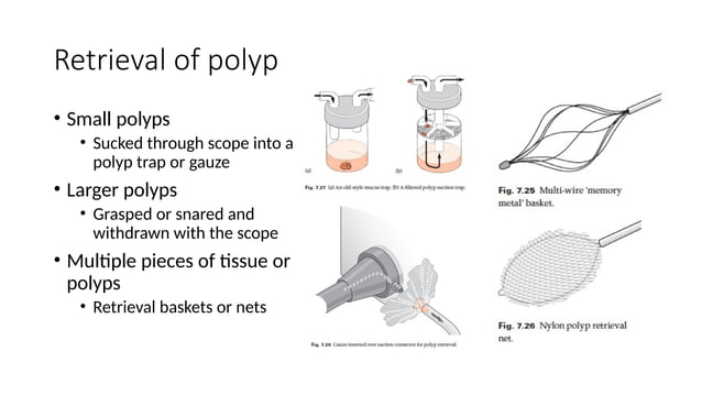 Colorectal polyps: recognition, characterisation and management | PPT