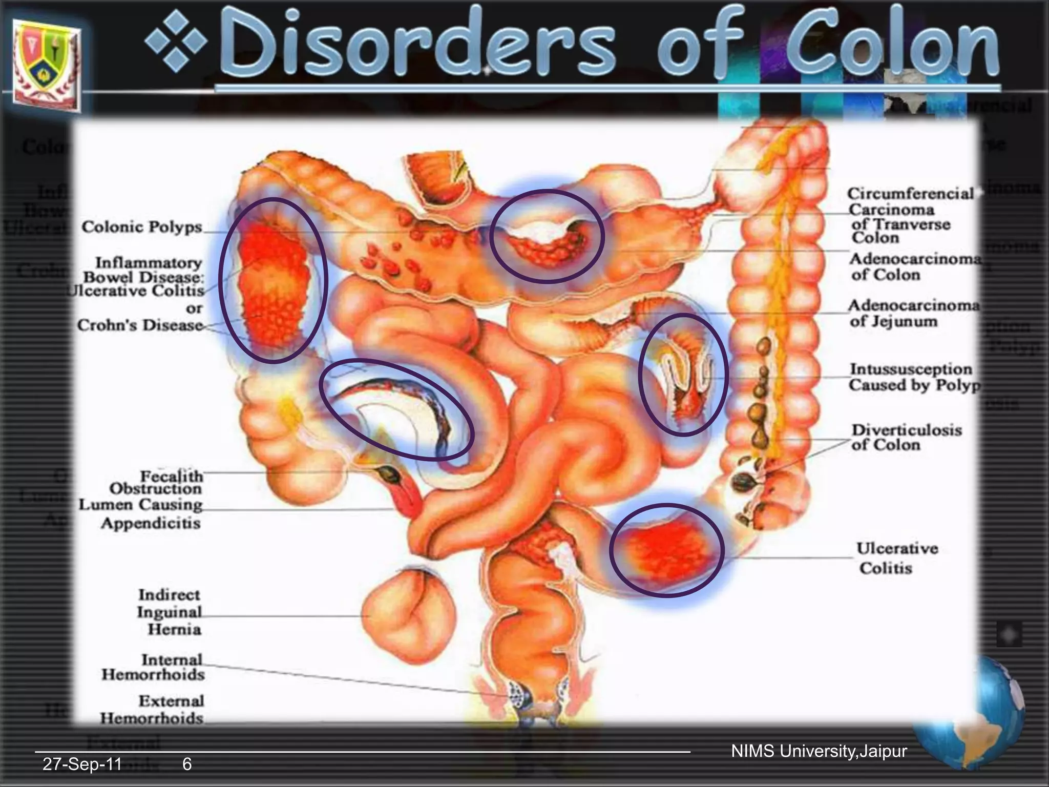 Colon Specific Drug Delivery System | PPTX