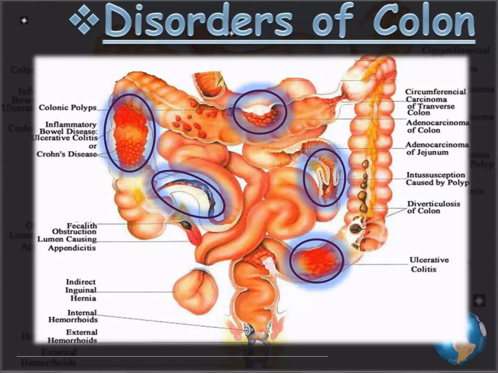 Colon targeted drug delivery systems | PPTX