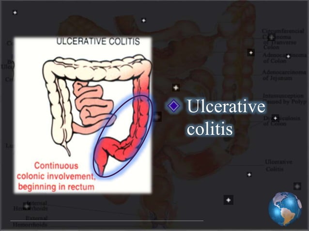 Colon targeted drug delivery systems | PPTX | Digestive Disorders ...