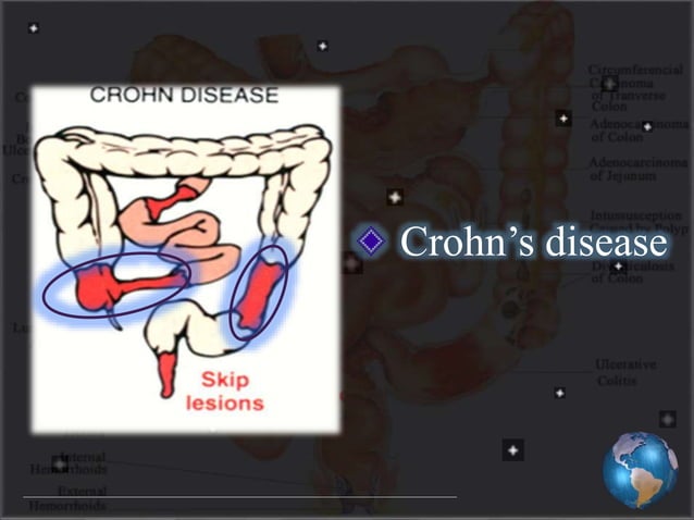 Colon targeted drug delivery systems | PPTX | Digestive Disorders ...