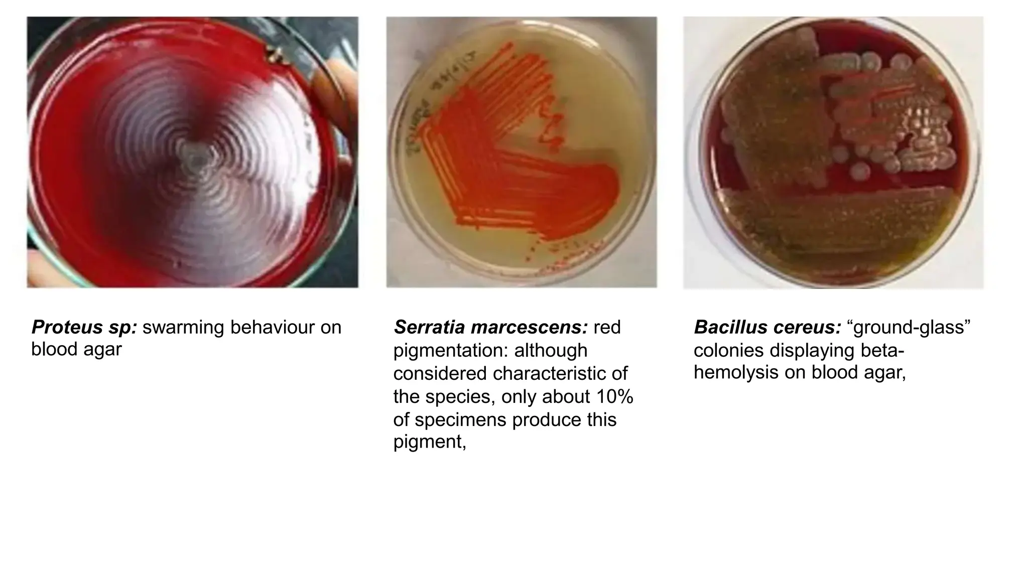 Different types of Bacterial Colony and their characteristics.pptx