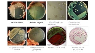 Different types of Bacterial Colony and their characteristics.pptx