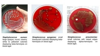 Different types of Bacterial Colony and their characteristics.pptx
