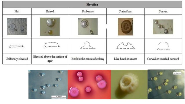 Different types of Bacterial Colony and their characteristics.pptx