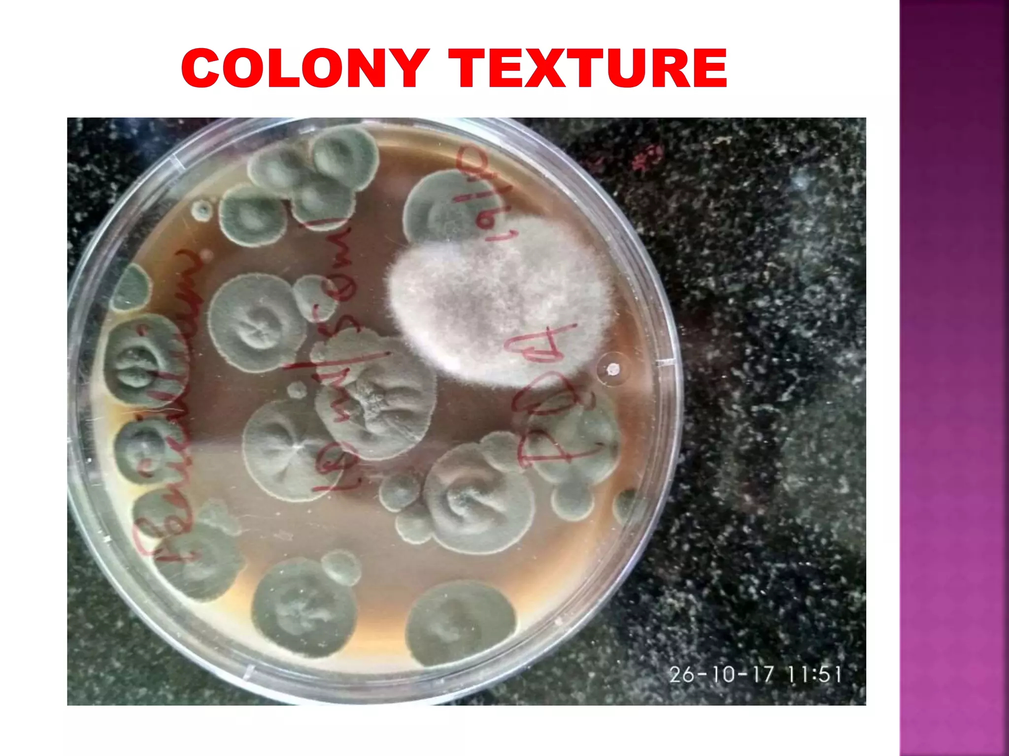 Colony Morphology & Characteristics of Cultures | PPTX