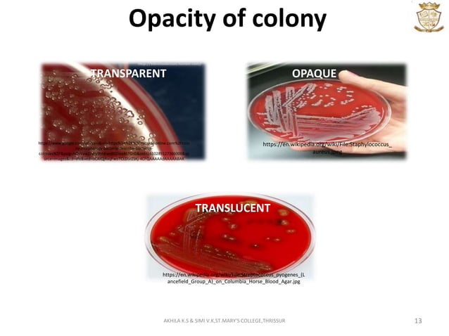 Colony Morphology and Characteristics of Culture | PPTX