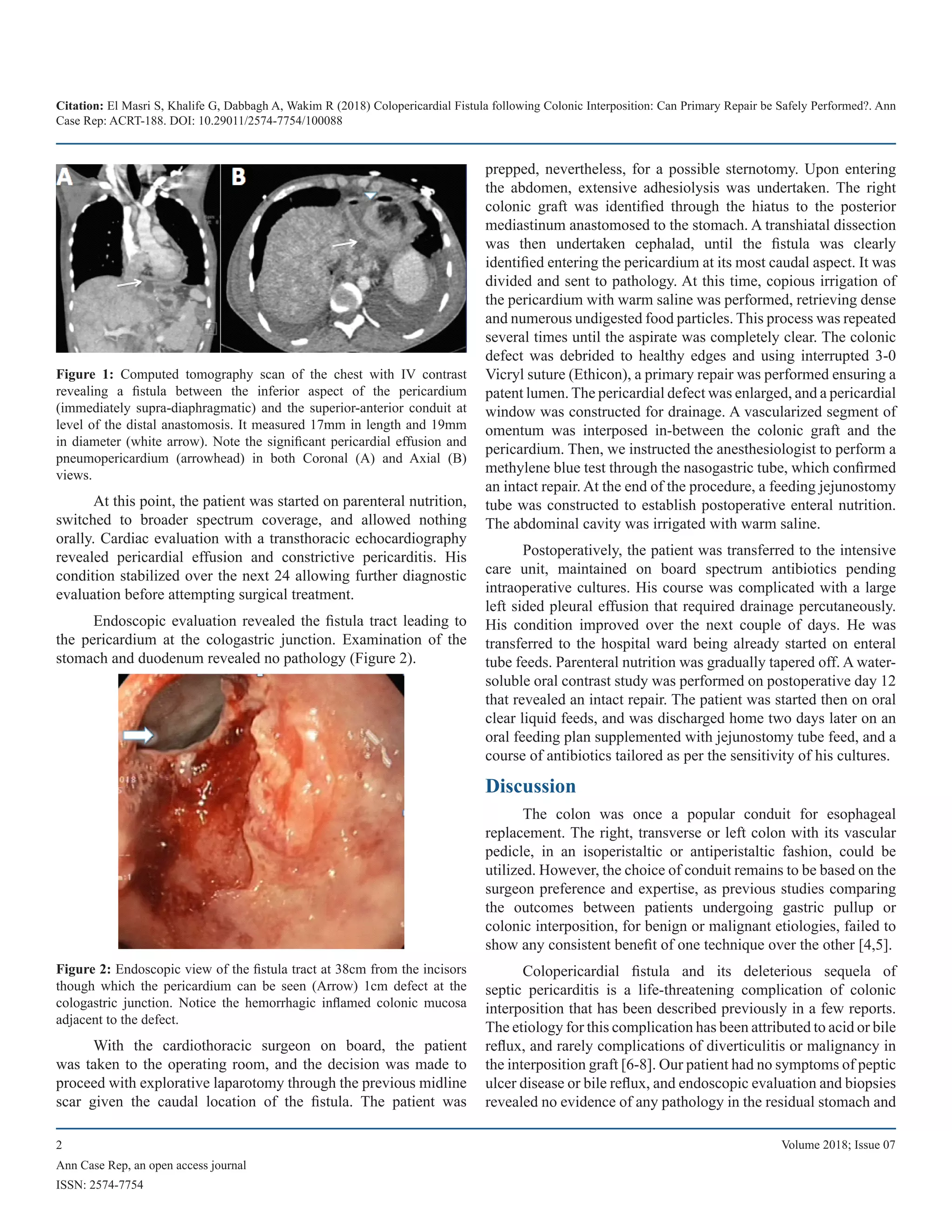 Colopericardial fistula following colonic interposition can primary ...