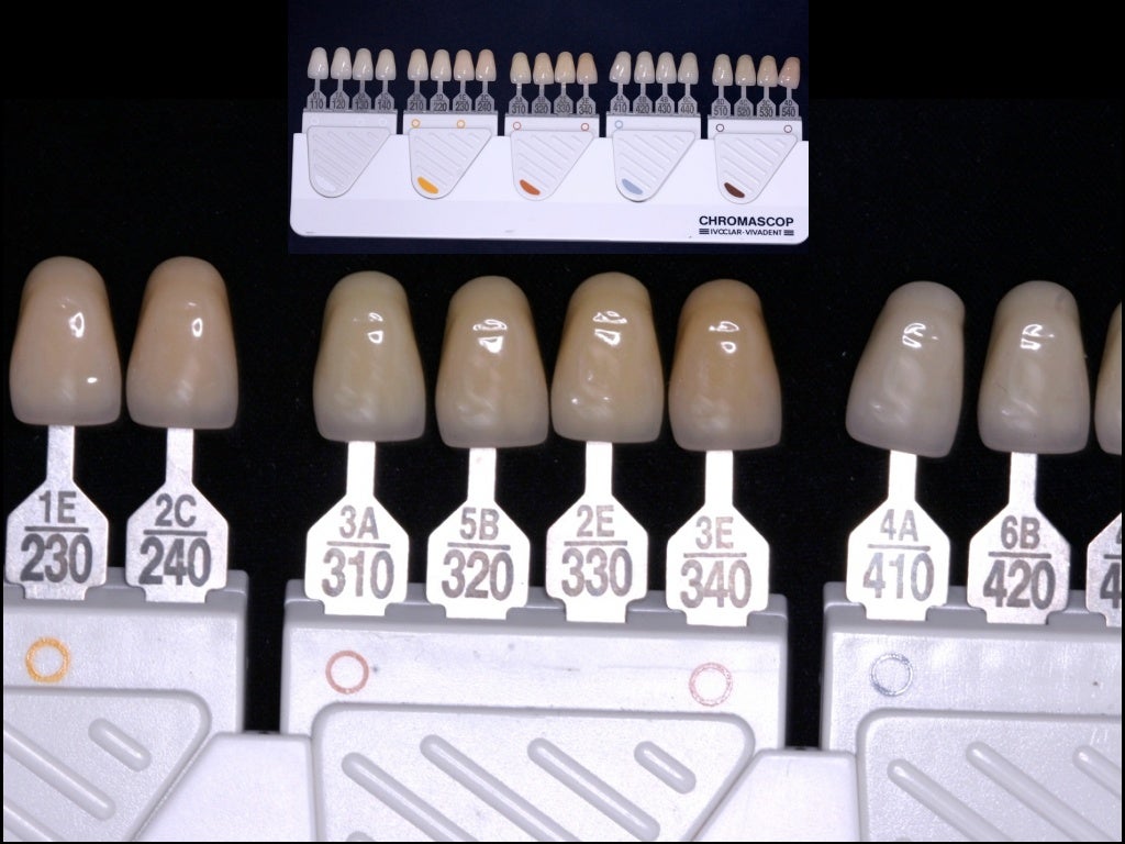 Color en Odontologia