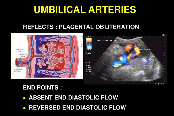 C O L O R D O P P L E R I N F E T A L H Y P O X I A
