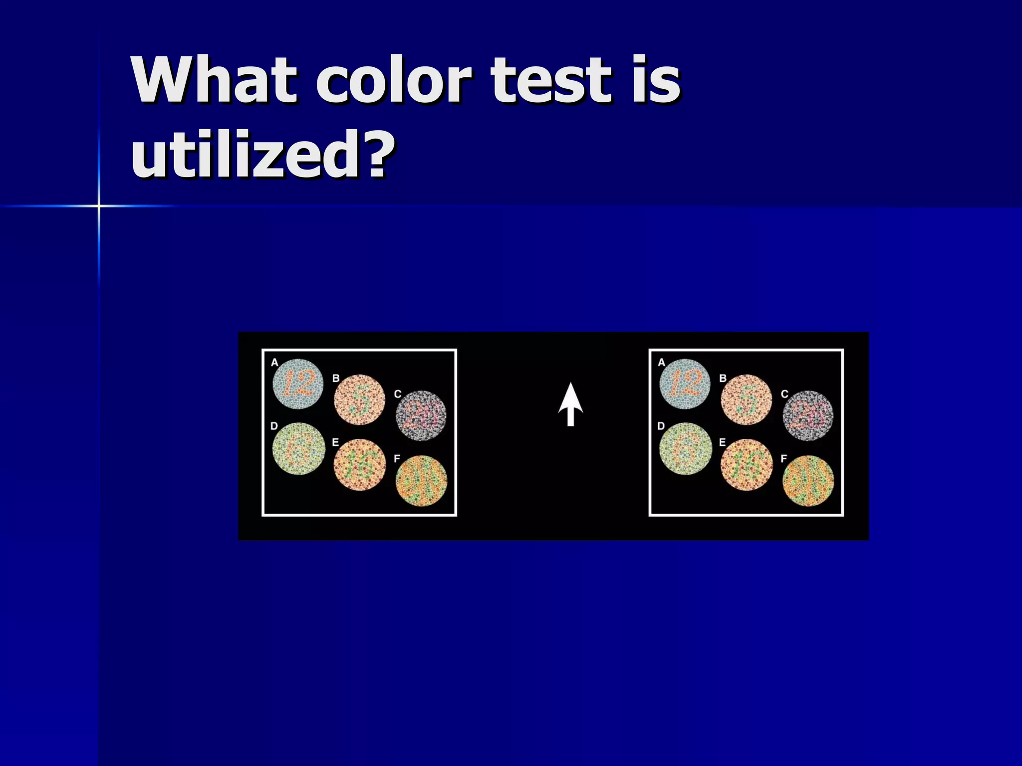 Color Vision Testing | PPT