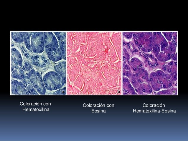 Coloraciom hematoxilina eosina y medios de montaje