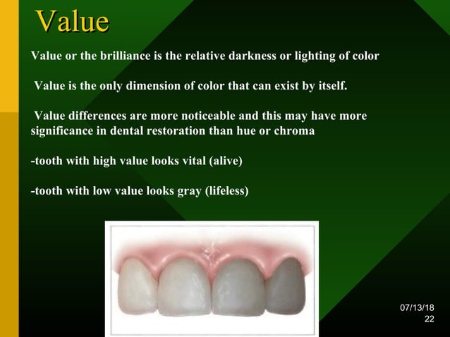 Colour and Shade Selection in dental practise | PPT | Eye and Vision ...