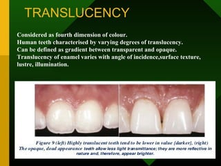 Colour and Shade Selection in dental practise | PPT