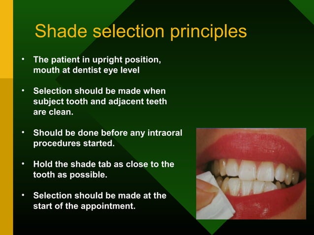 Colour and Shade Selection in dental practise | PPT | Eye and Vision ...
