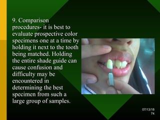 Colour and Shade Selection in dental practise | PPT