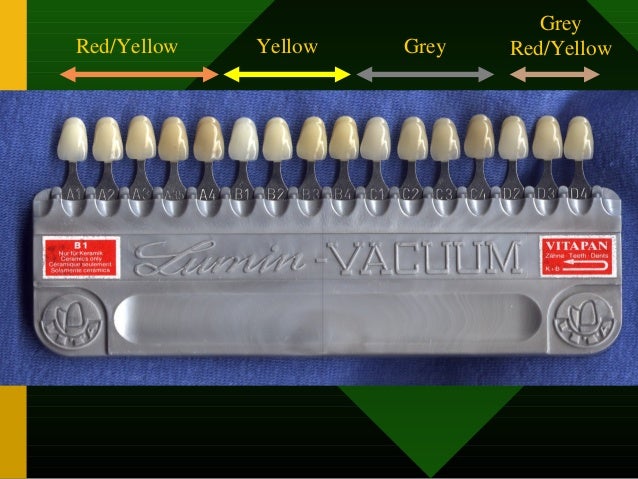Colour and Shade Selection in dental practise