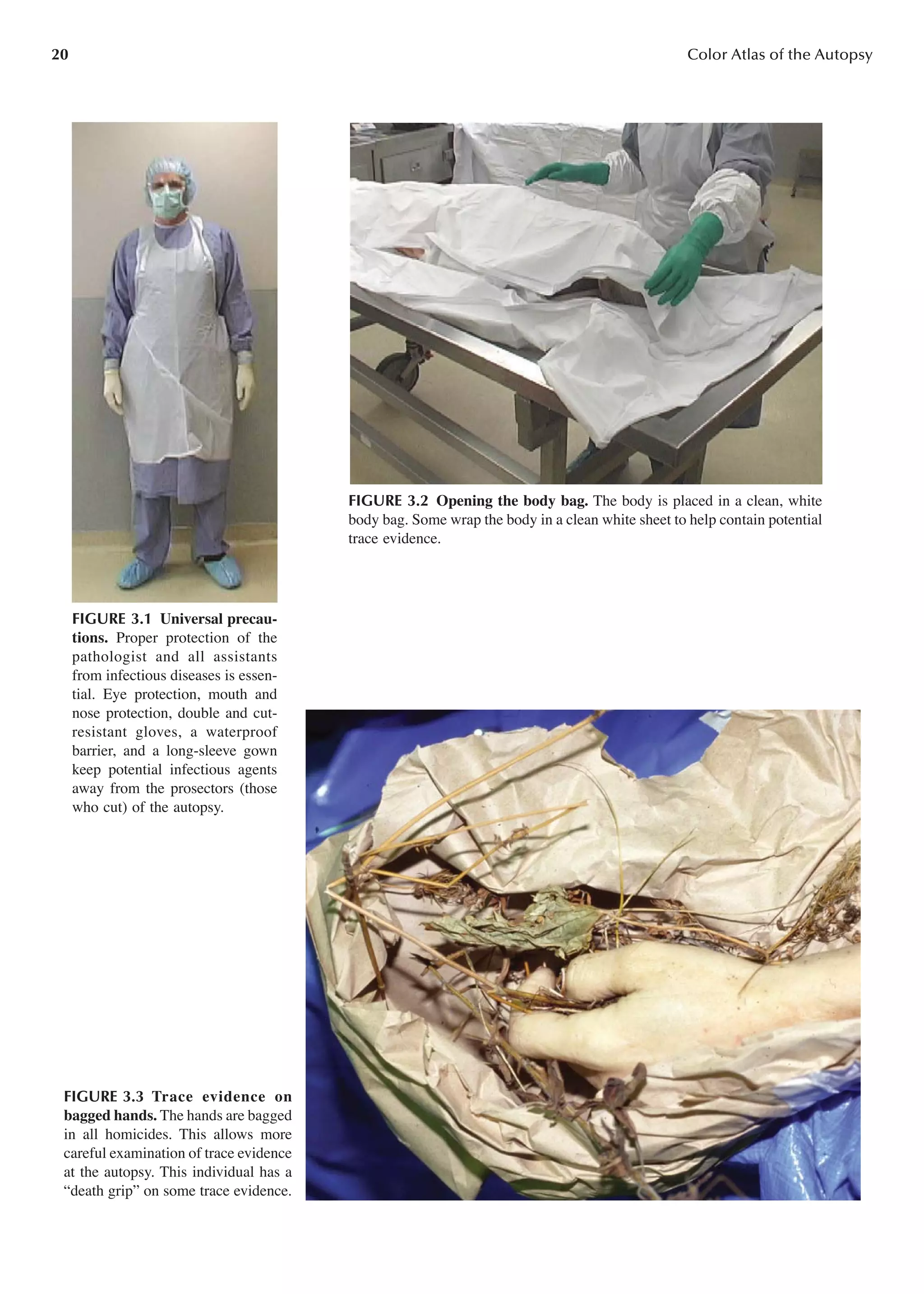 Color atlas of autopsy (drm.coder) BY Dr vimal prakash | PDF