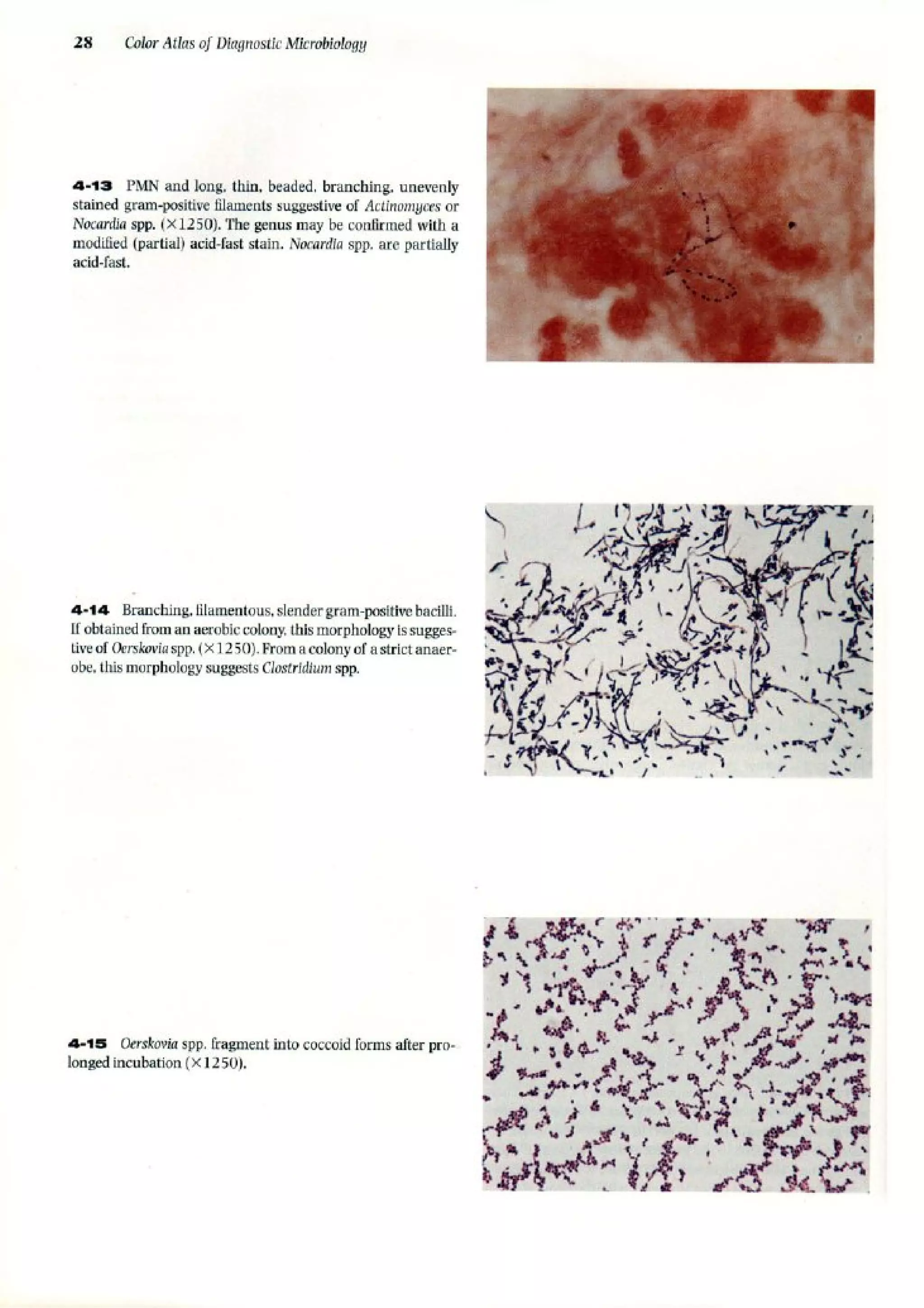 Color atlas of diagnostic microbiology | PDF