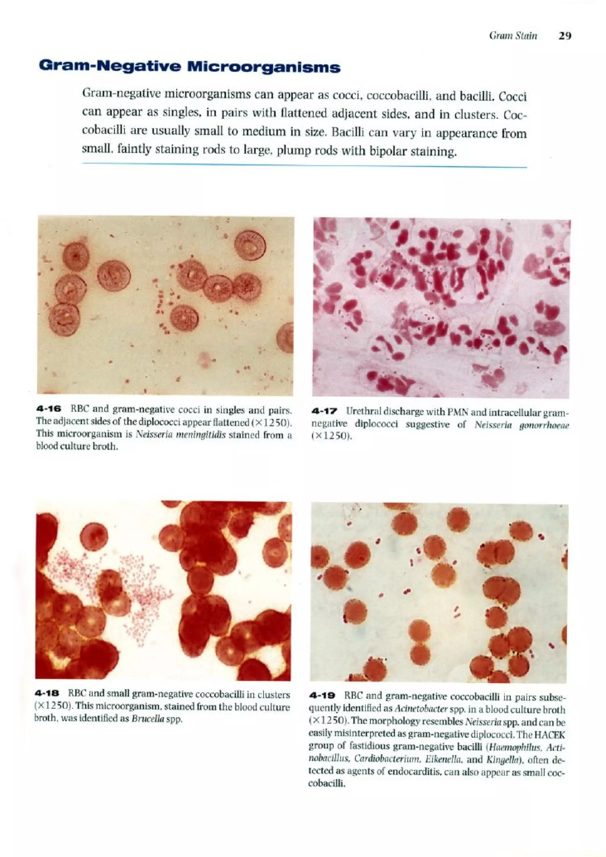 Color atlas of diagnostic microbiology | PDF