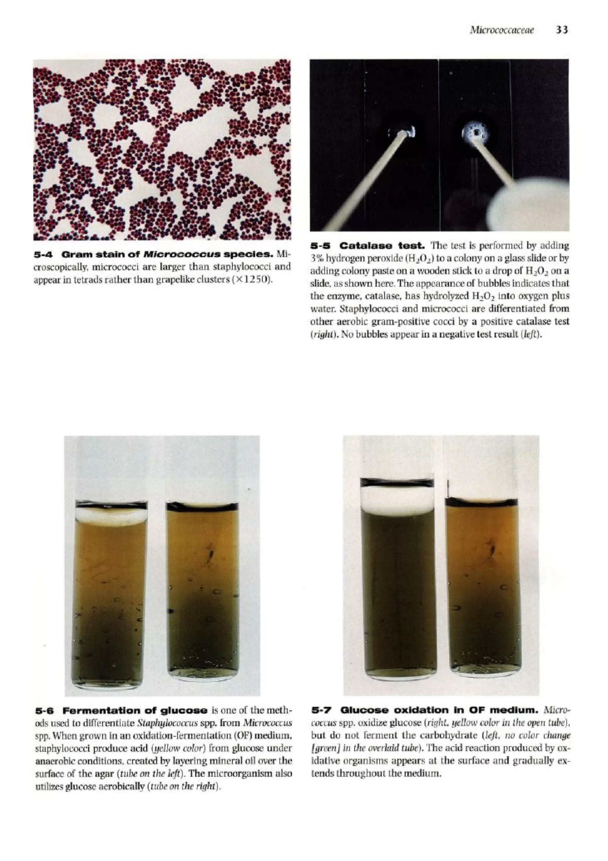 Color atlas of diagnostic microbiology | PDF