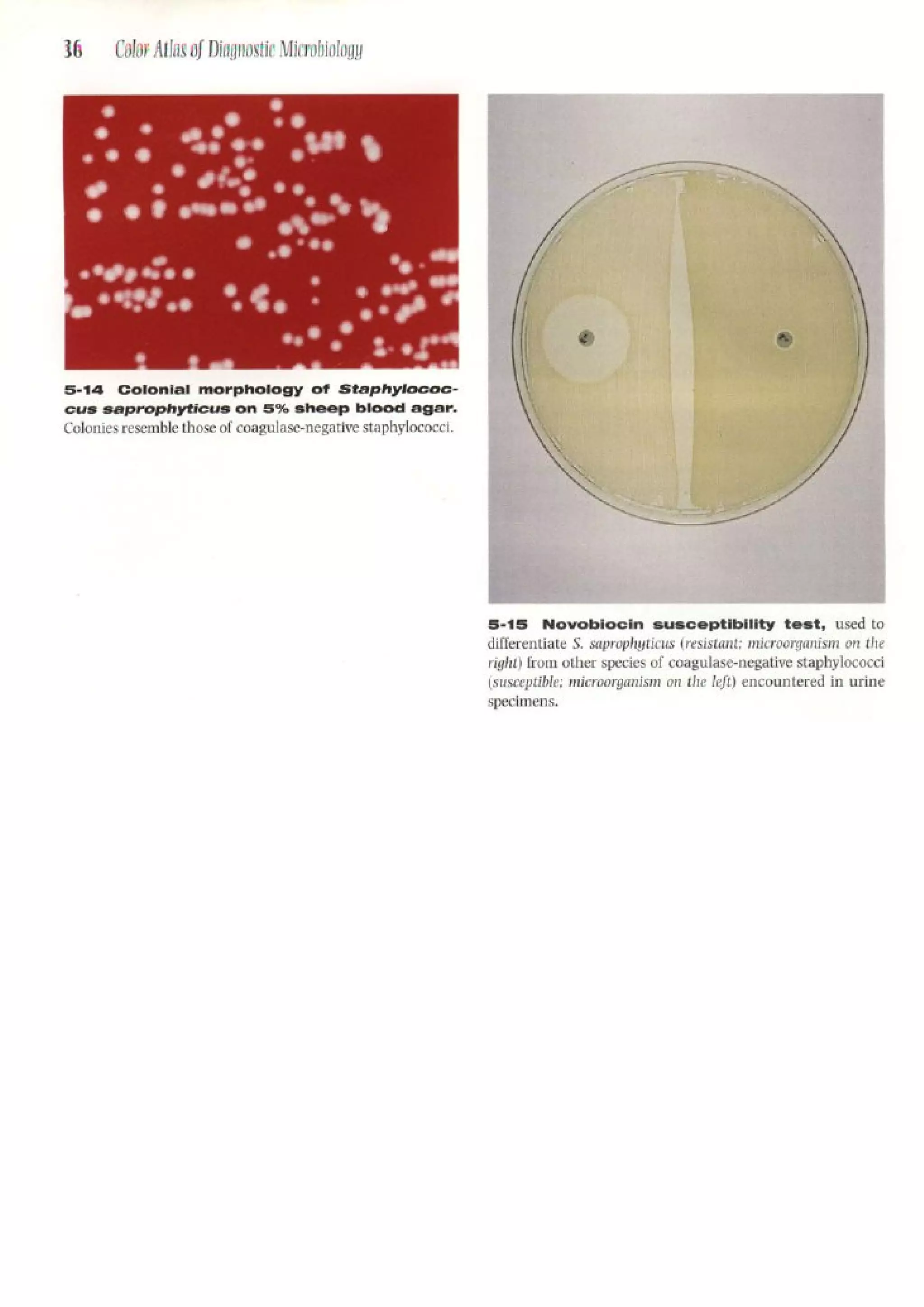 Color atlas of diagnostic microbiology | PDF
