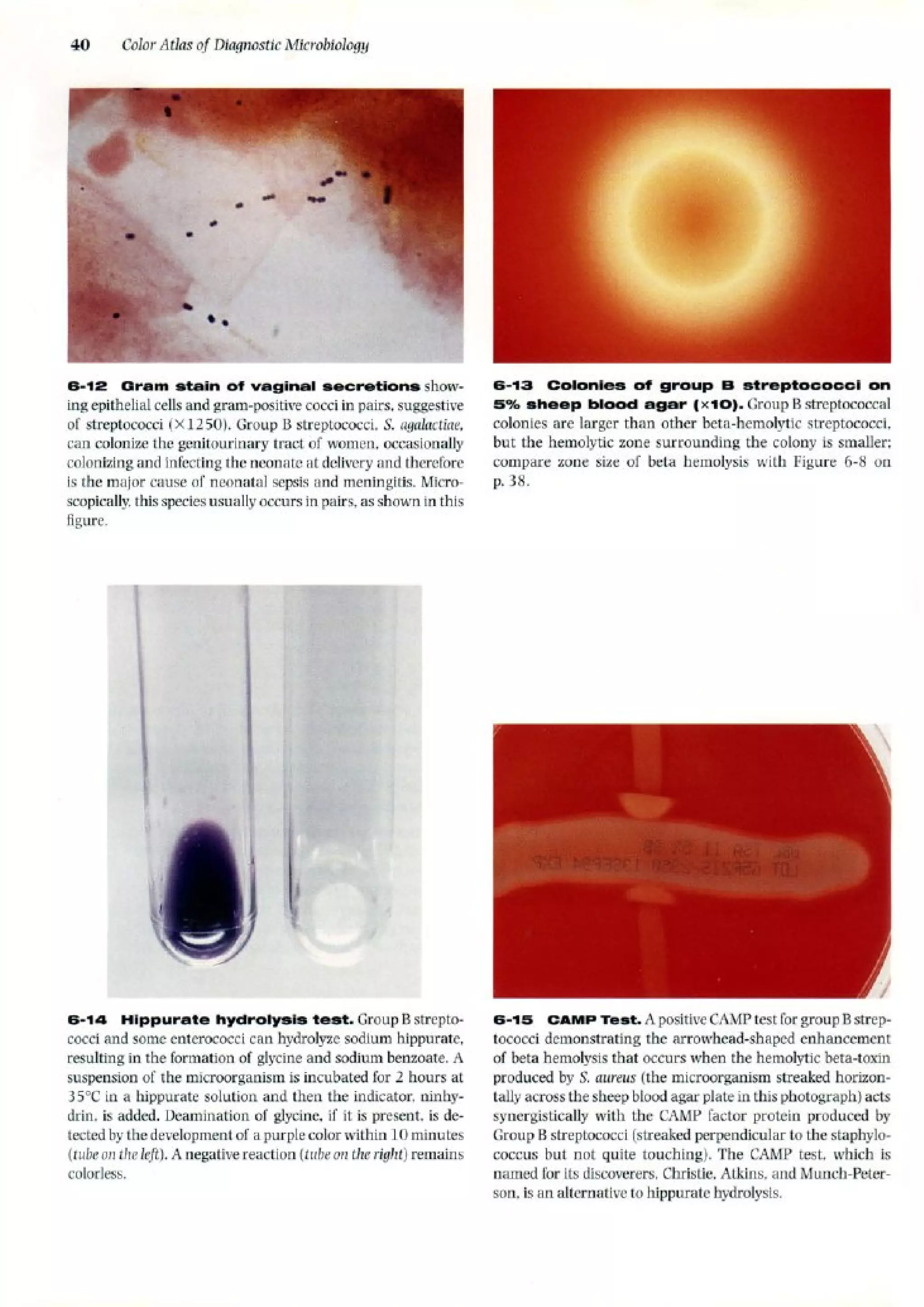 Color atlas of diagnostic microbiology | PDF