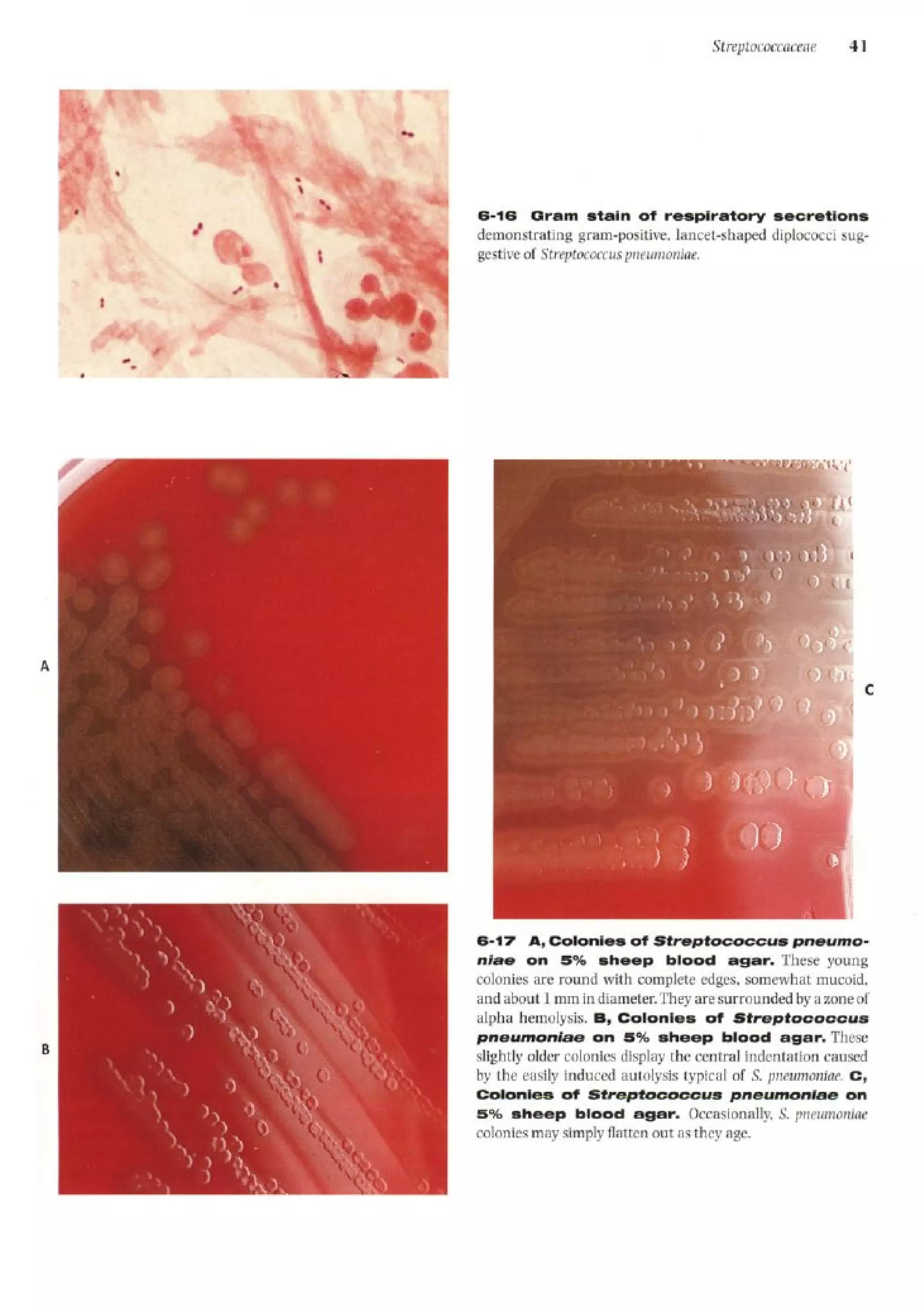 Color atlas of diagnostic microbiology | PDF