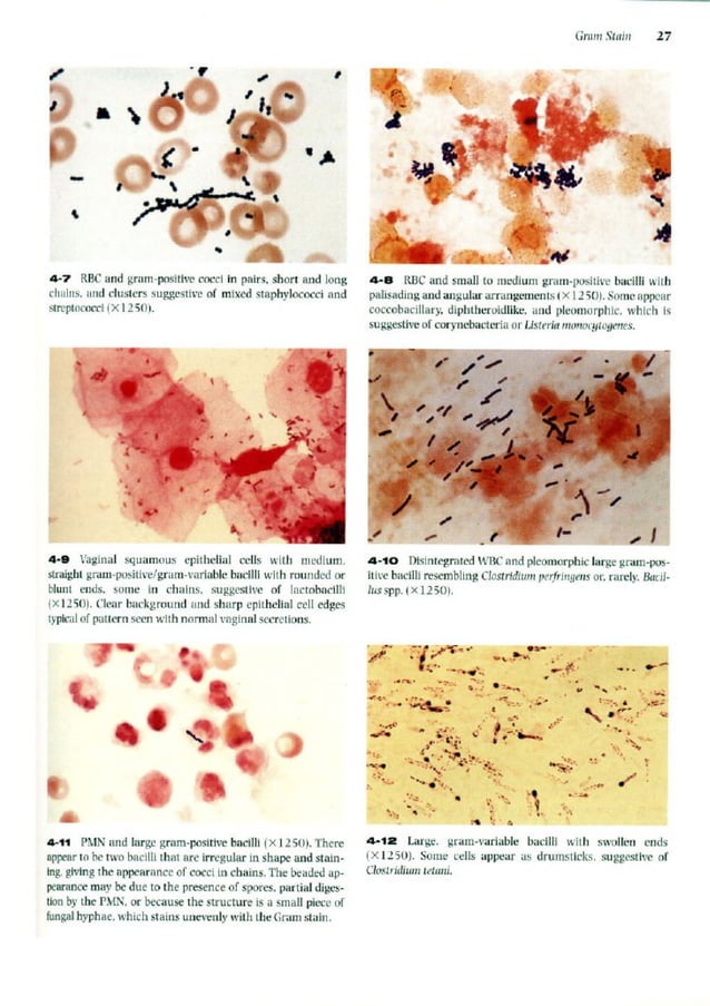 Color atlas of diagnostic microbiology | PDF