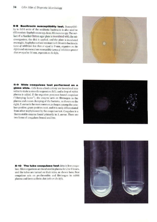 Color atlas of diagnostic microbiology | PDF